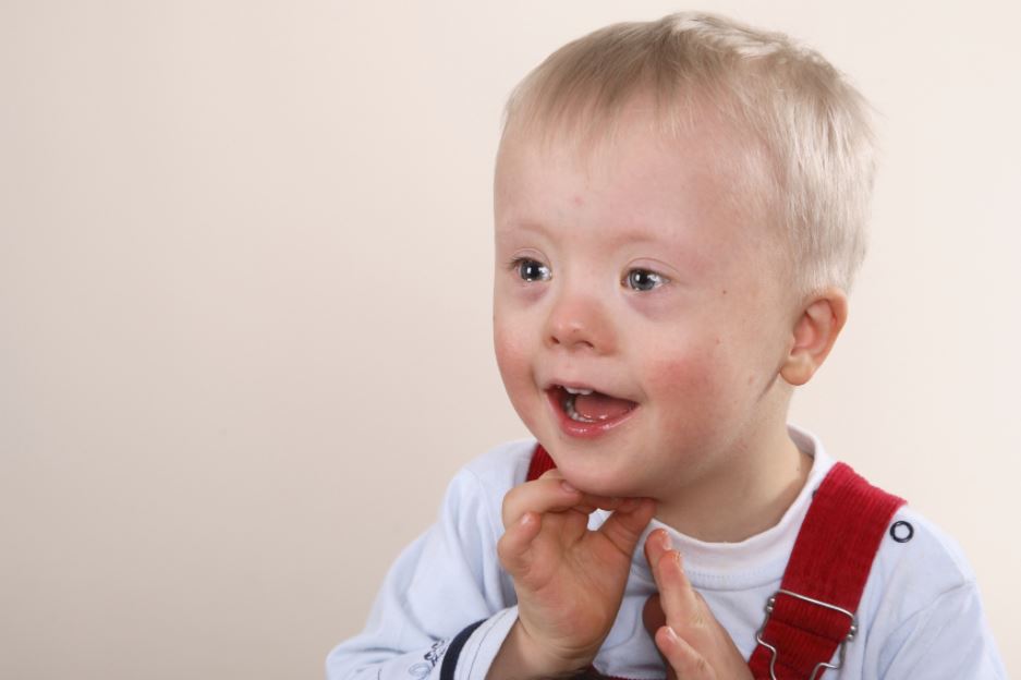 Les parents d’un enfant trisomique refusent l’avortement et ne le ...