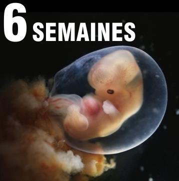 L’avortement, ou la question qui tue - Campagne Québec-Vie