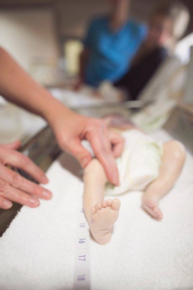 Une mère partage les photos de son bébé atteint d'acrânie décédé à la ...