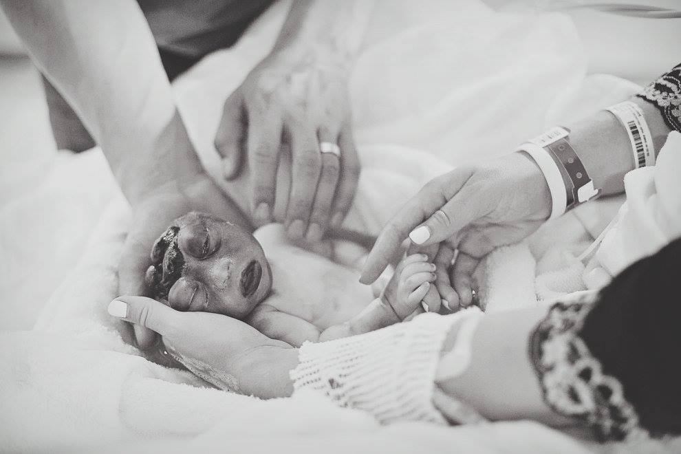 Une mère partage les photos de son bébé atteint d'acrânie décédé à la ...